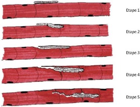 Memoire Online - Séroprévalence de la trichinellose dans la région de ...